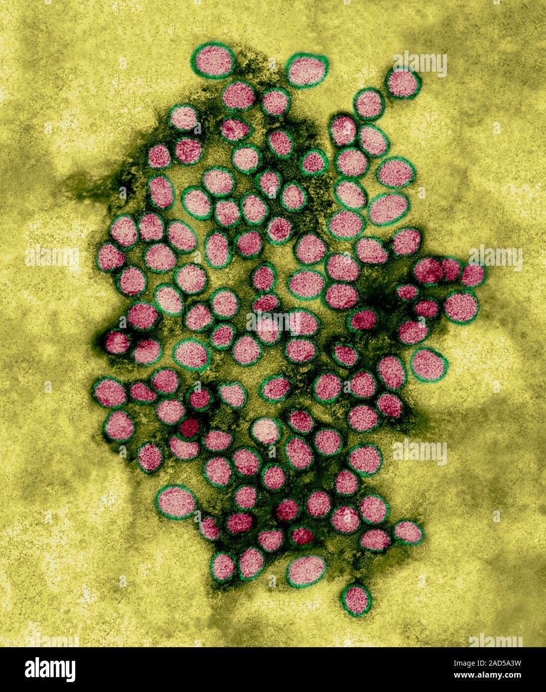 Yellow fever virus particles (virions), coloured transmission electron ...