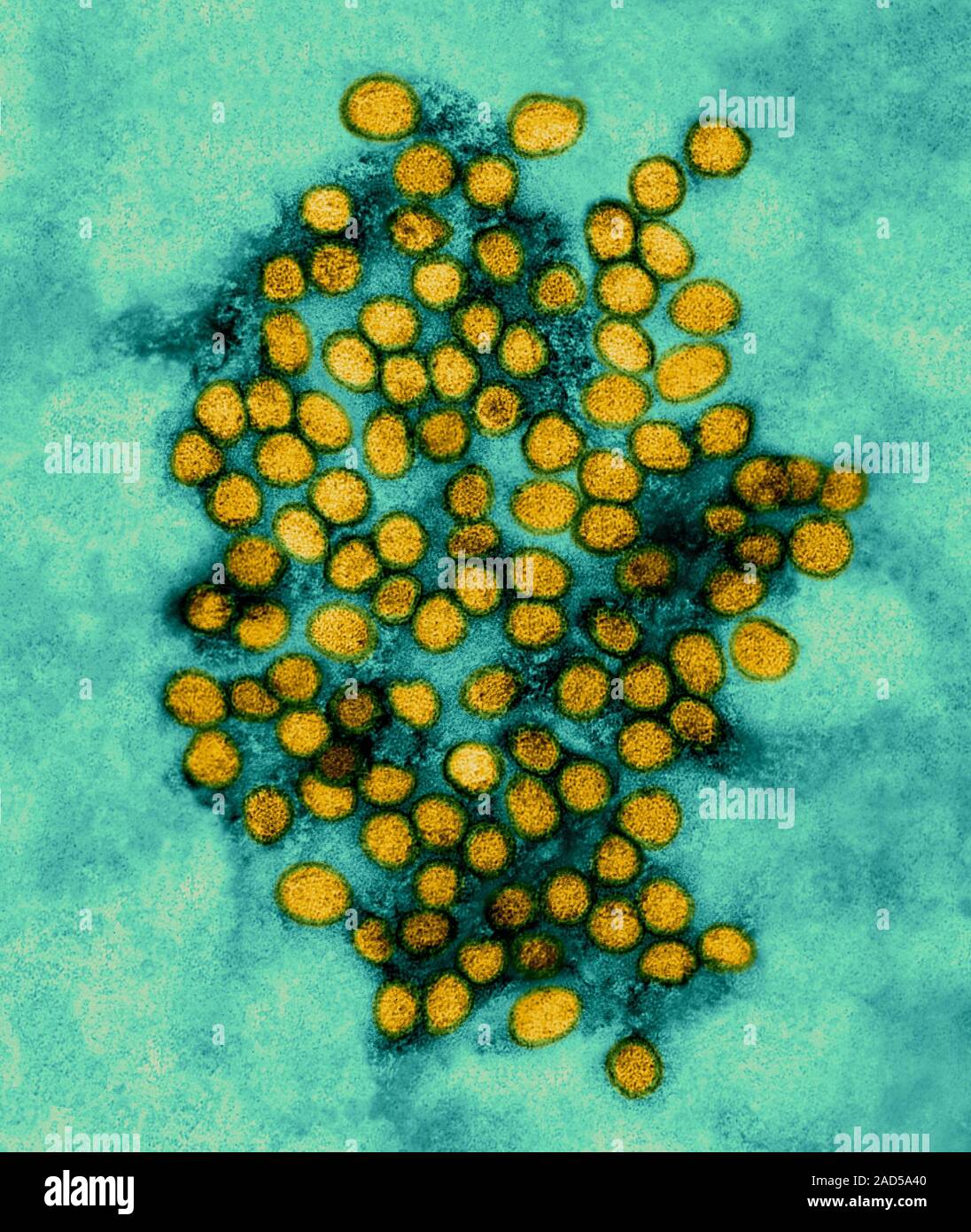 Yellow fever virus particles (virions), coloured transmission electron ...