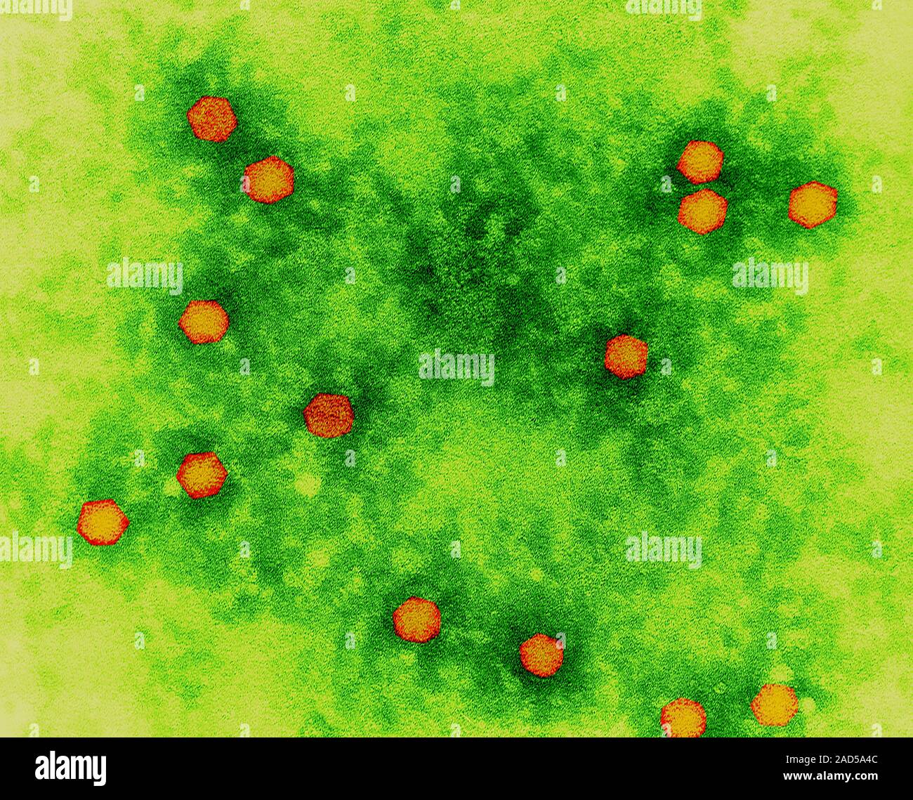 Polio virus, cause of poliomyelitis, RNA virus (Enterovirus C ...