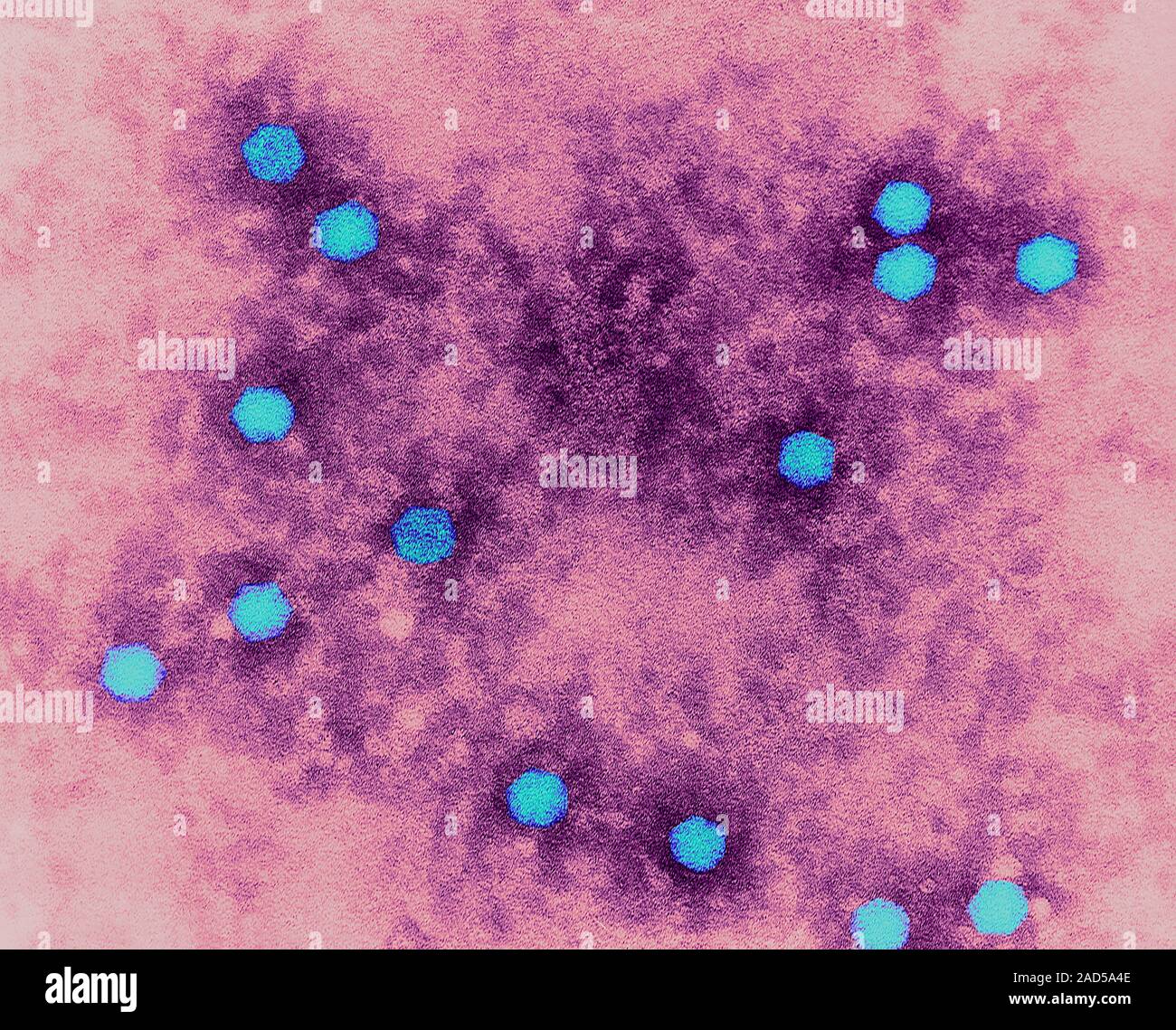 Polio virus, cause of poliomyelitis, RNA virus (Enterovirus C ...