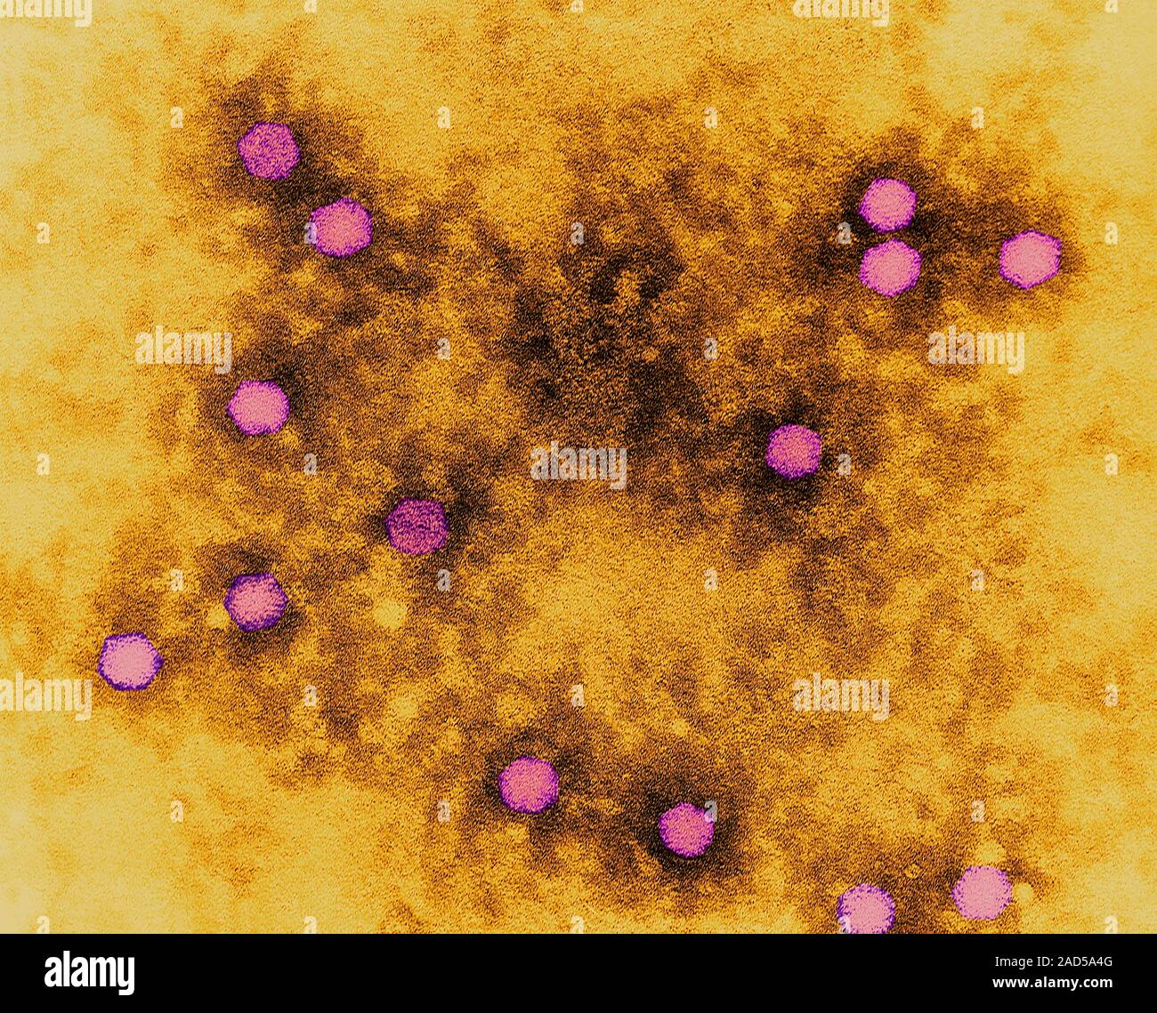 Polio virus, cause of poliomyelitis, RNA virus (Enterovirus C ...