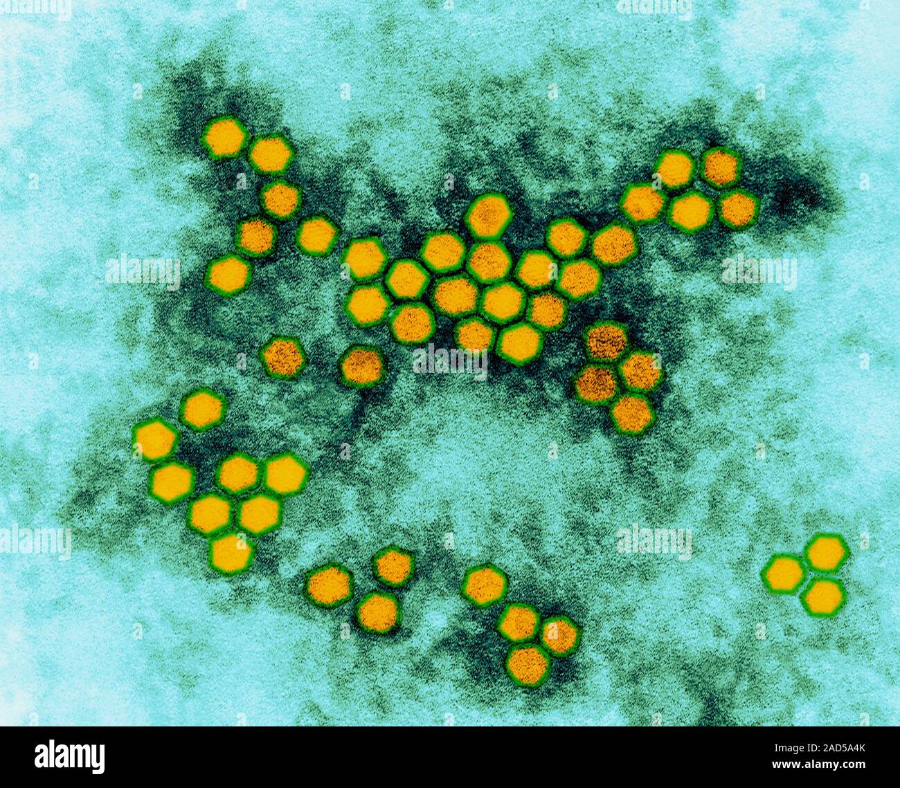 Polio virus, cause of poliomyelitis, RNA virus (Enterovirus C ...