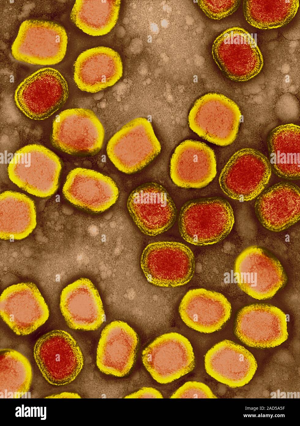 Variola virus, the cause of smallpox (DNA virus, Family Poxviridae ...