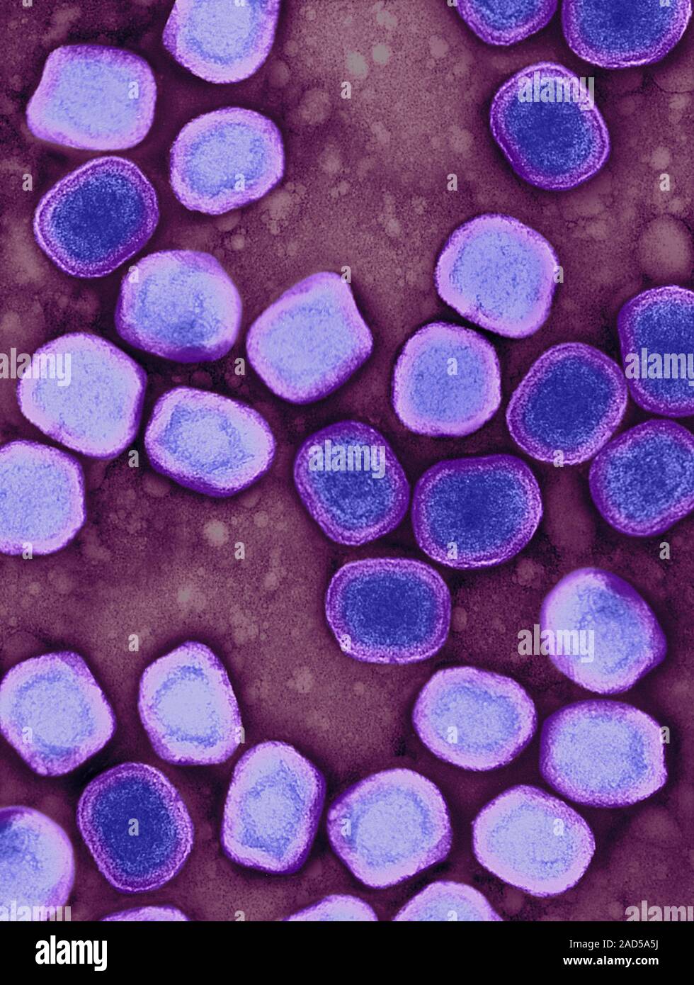 Variola virus, the cause of smallpox (DNA virus, Family Poxviridae ...