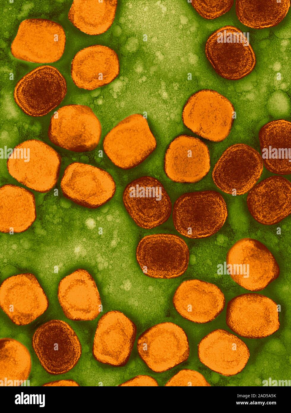 Variola virus, the cause of smallpox (DNA virus, Family Poxviridae ...