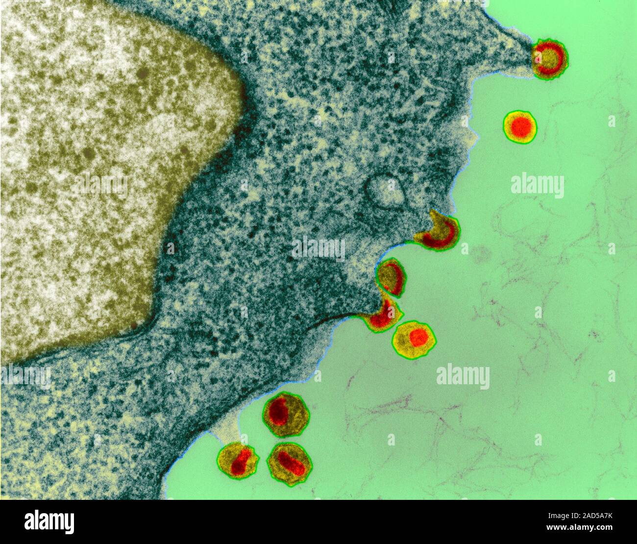 HIV infection, coloured transmission electron micrograph (TEM). Mature ... HIV infection, coloured transmission electron micrograph (TEM). Mature ...