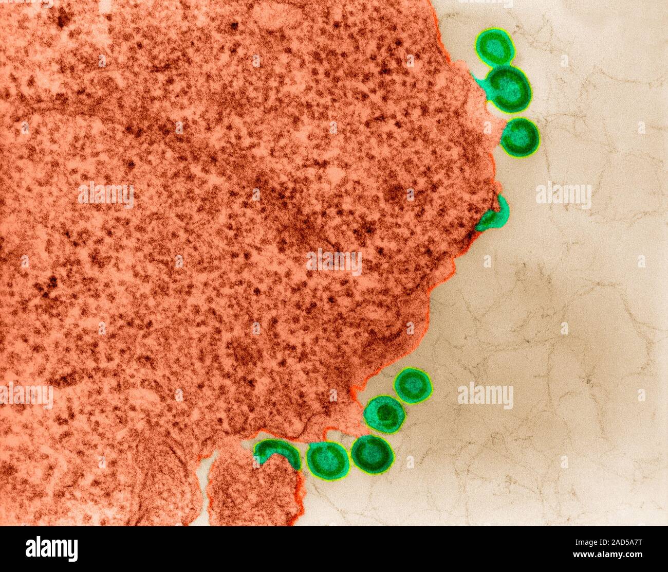 HIV infection, coloured transmission electron micrograph (TEM). Mature ... HIV infection, coloured transmission electron micrograph (TEM). Mature ...