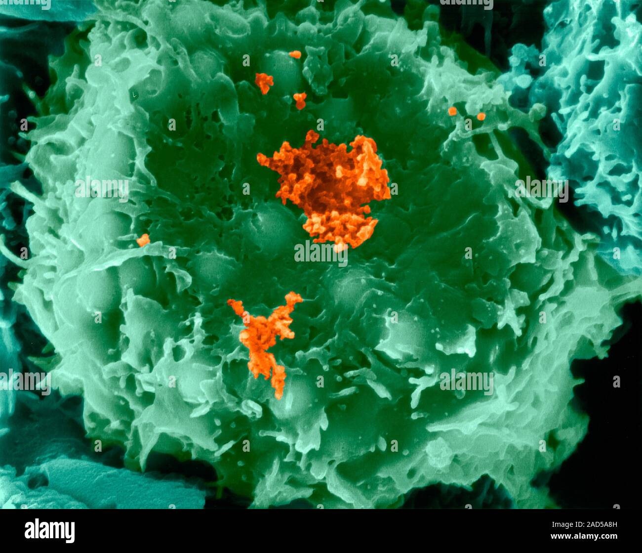 Human T lymphocyte with HTLV-1 infection, coloured scanning electron ...