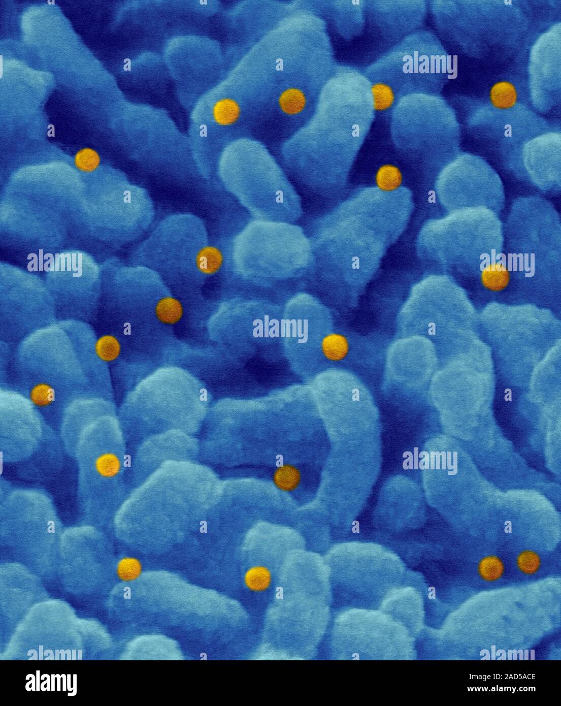 Rhinovirus, cause of the common cold (Picornaviridae family, RNA virus ...