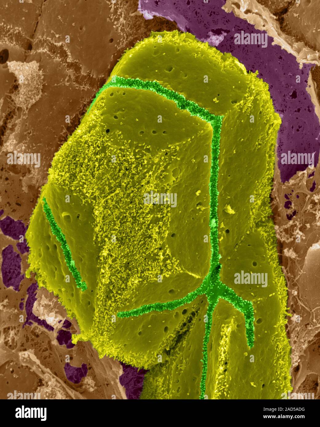 Liver polygonal hepatocytes and sinusoid area, coloured scanning ...