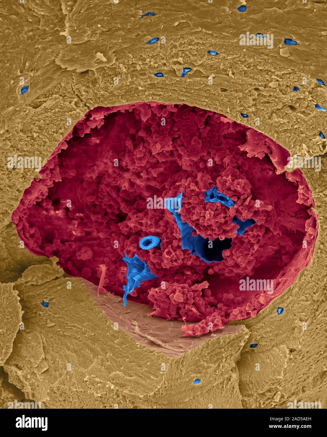 Compact bone and bone marrow cavity (lacuna), coloured scanning ...