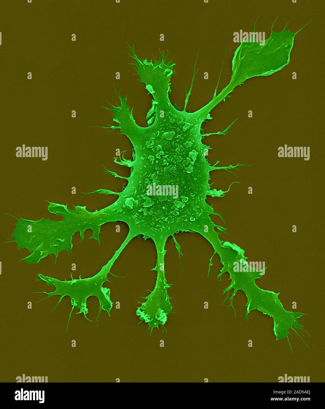 Human dendritic cell, coloured scanning electron micrograph (SEM ...