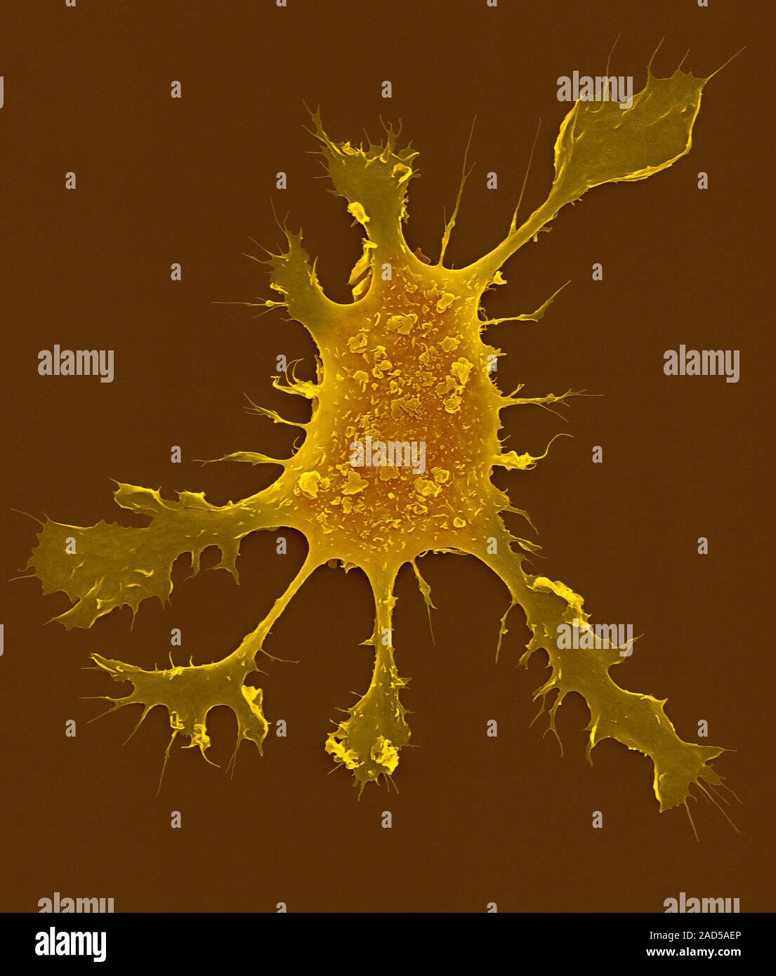 Human dendritic cell, coloured scanning electron micrograph (SEM ...