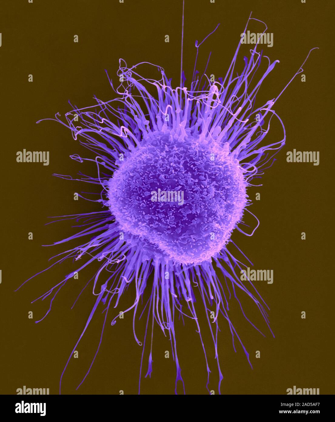 Human dendritic cell, coloured scanning electron micrograph (SEM ...