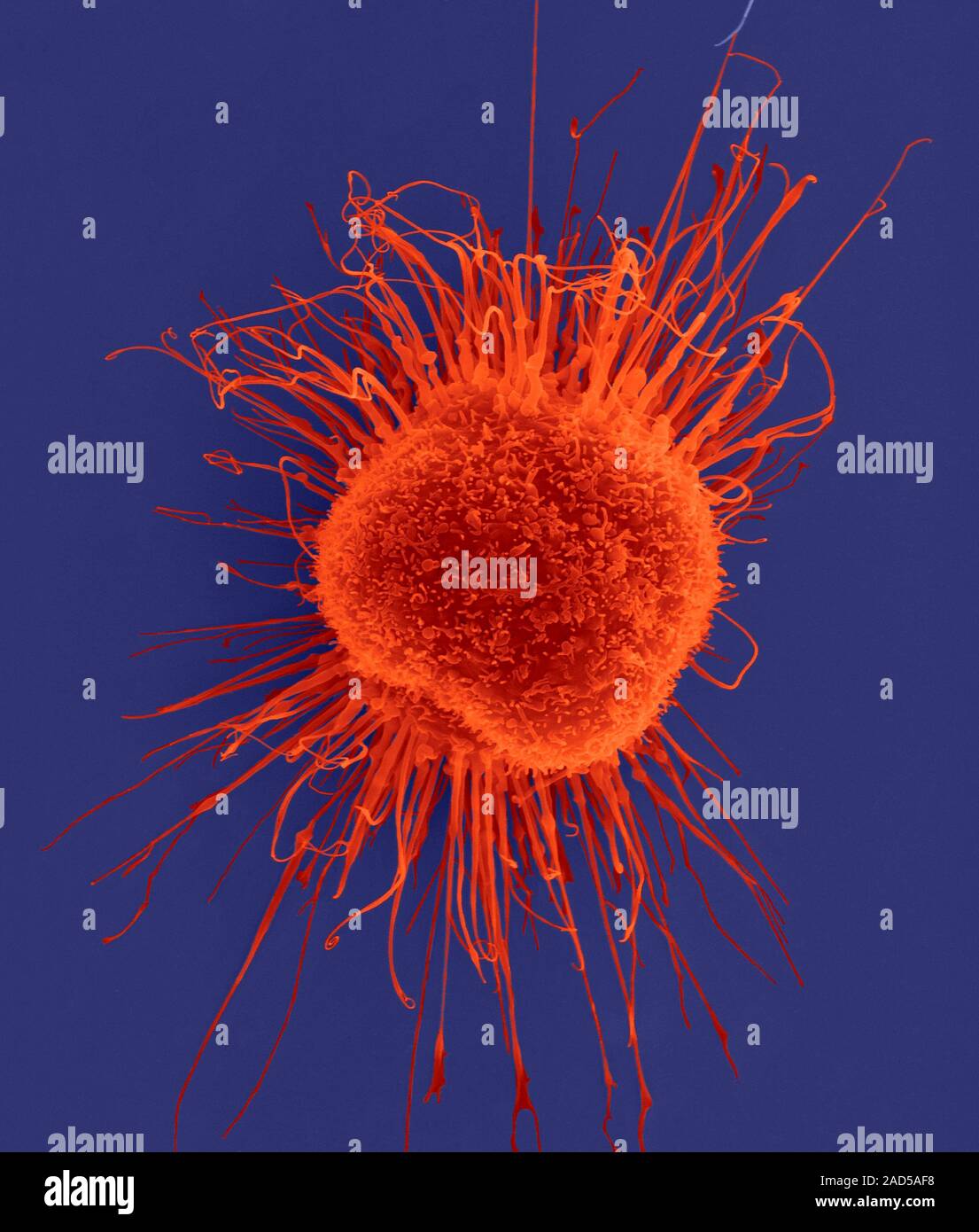 Human dendritic cell, coloured scanning electron micrograph (SEM ...