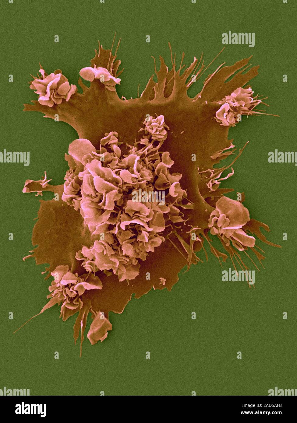 Human dendritic cell, coloured scanning electron micrograph (SEM ...