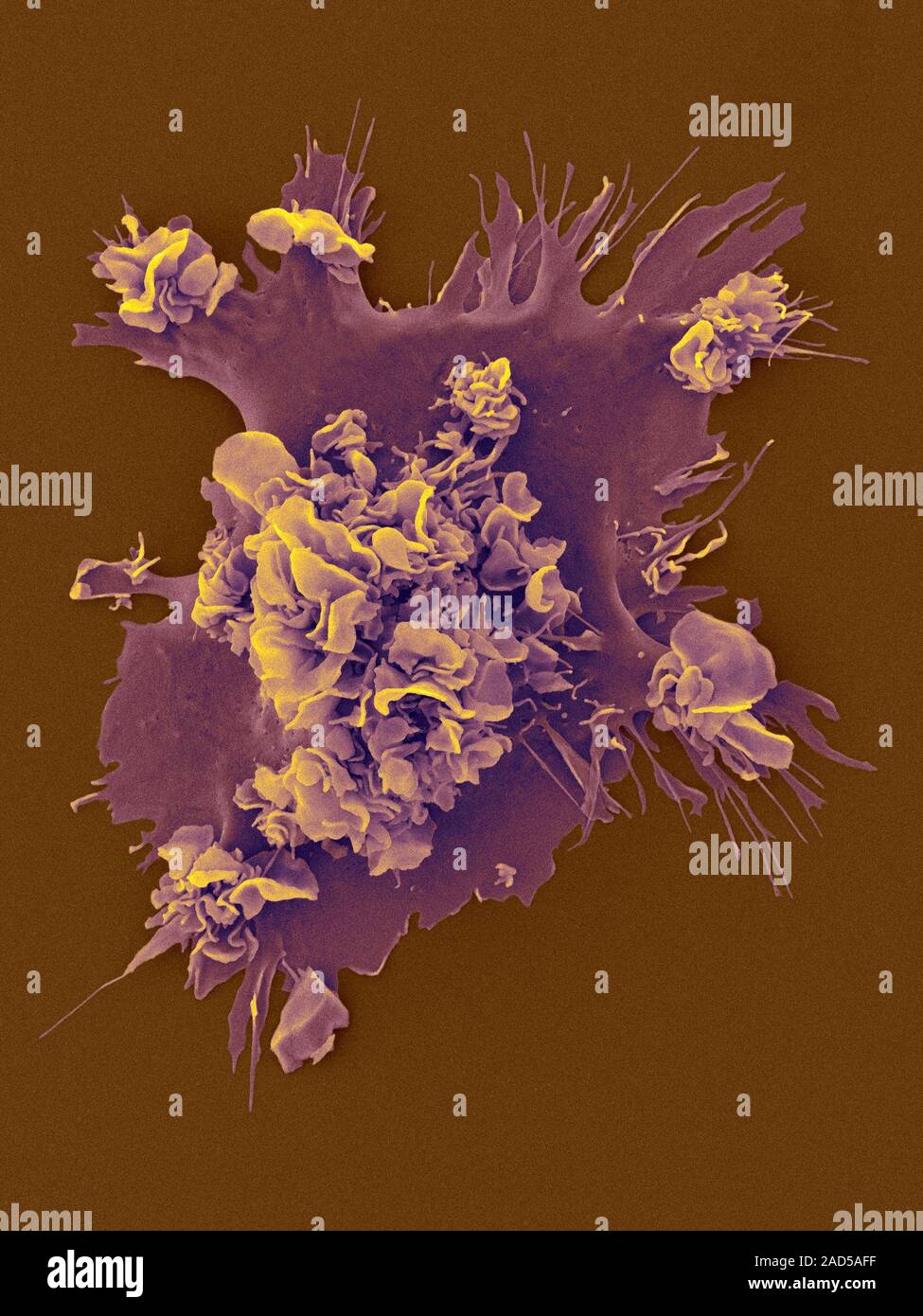 Human dendritic cell, coloured scanning electron micrograph (SEM ...