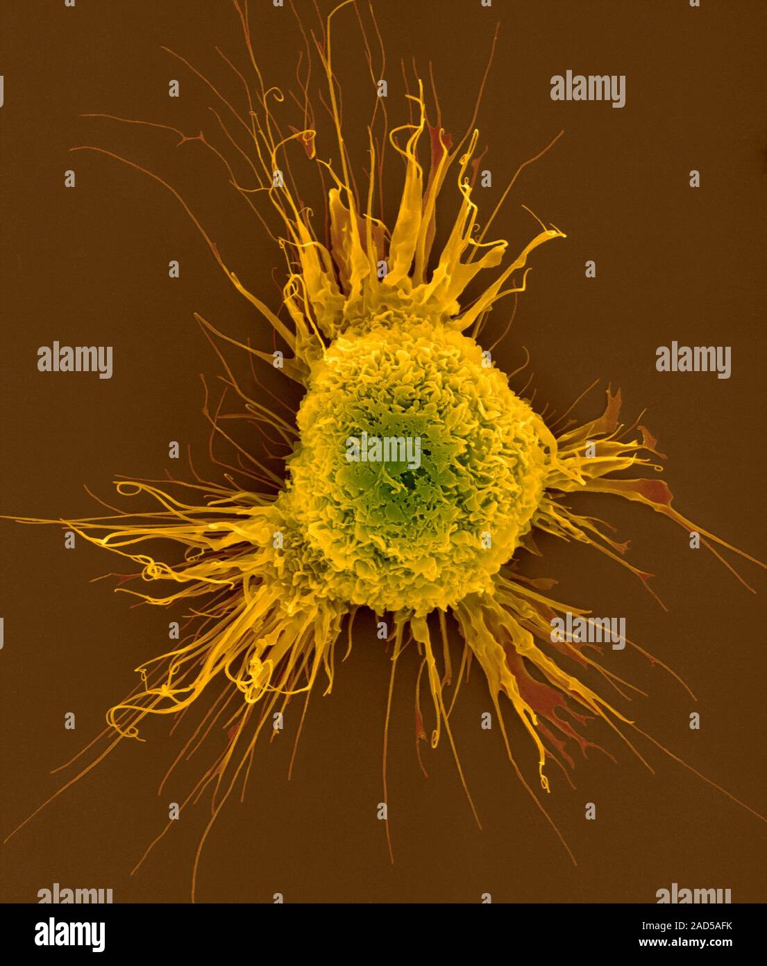 Mouse dendritic cell, coloured scanning electron micrograph (SEM ...