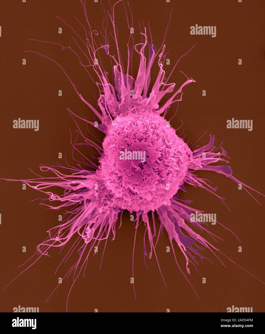 Mouse dendritic cell, coloured scanning electron micrograph (SEM ...