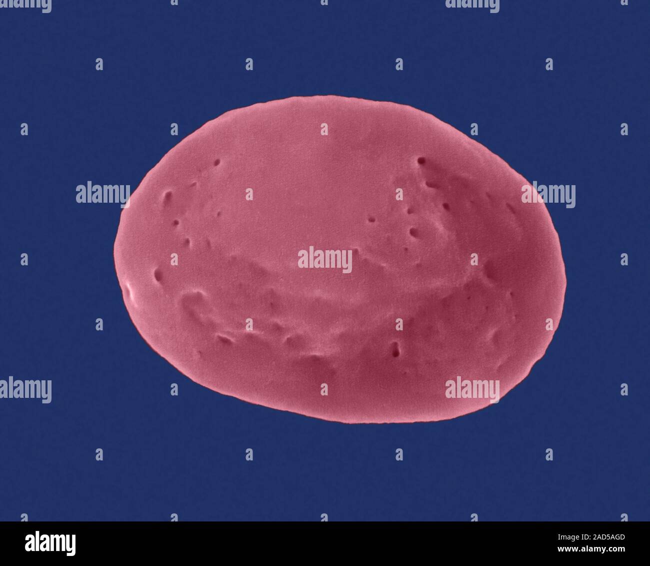 Non-activated platelet with channels of the open canalicular system ...