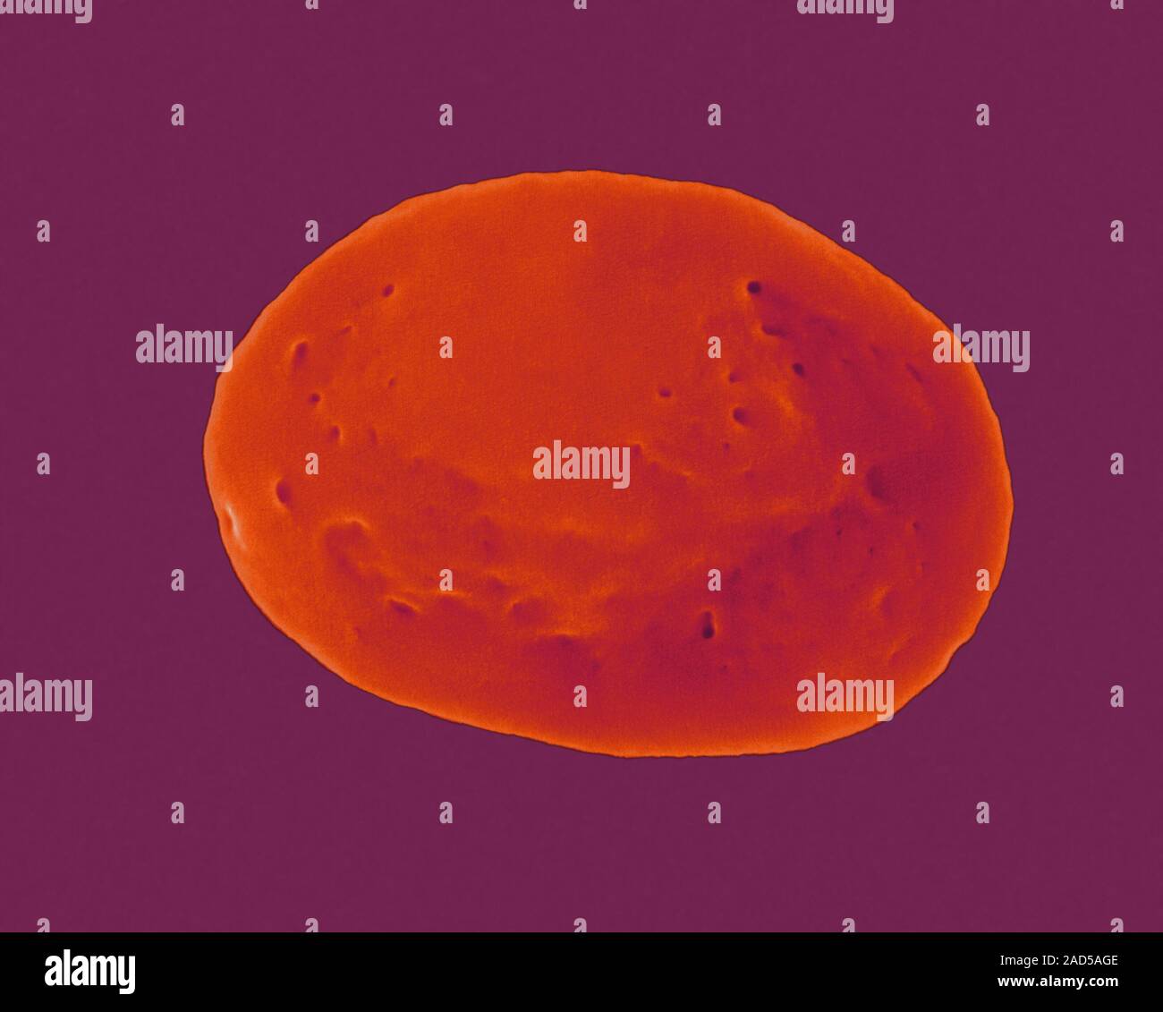Non-activated platelet with channels of the open canalicular system ...