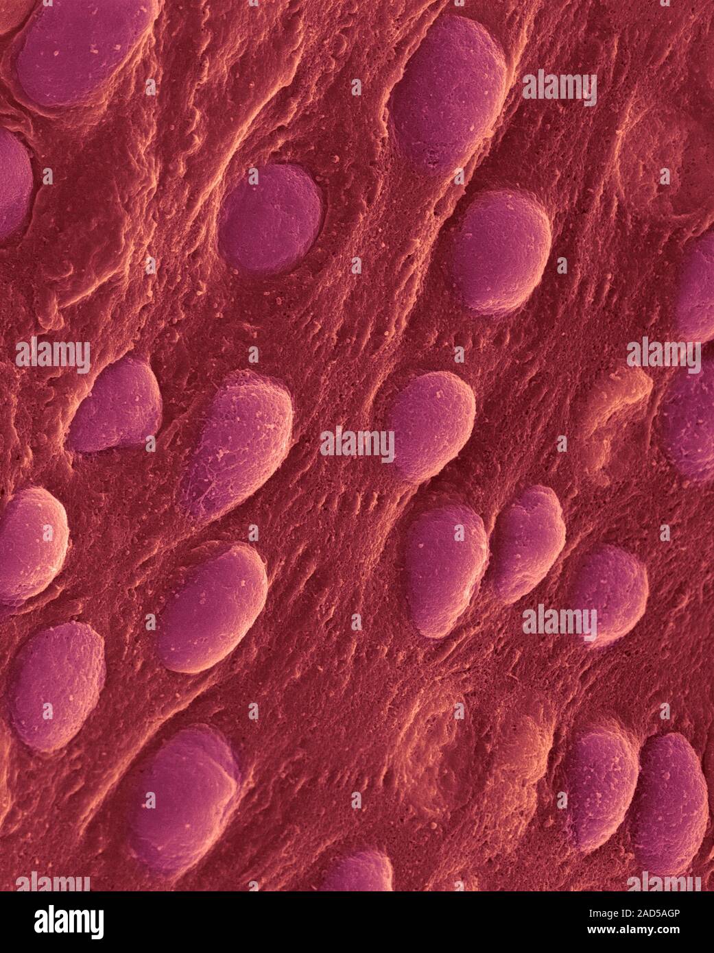 Surface of the heart pericardium, coloured scanning electron micrograph ...