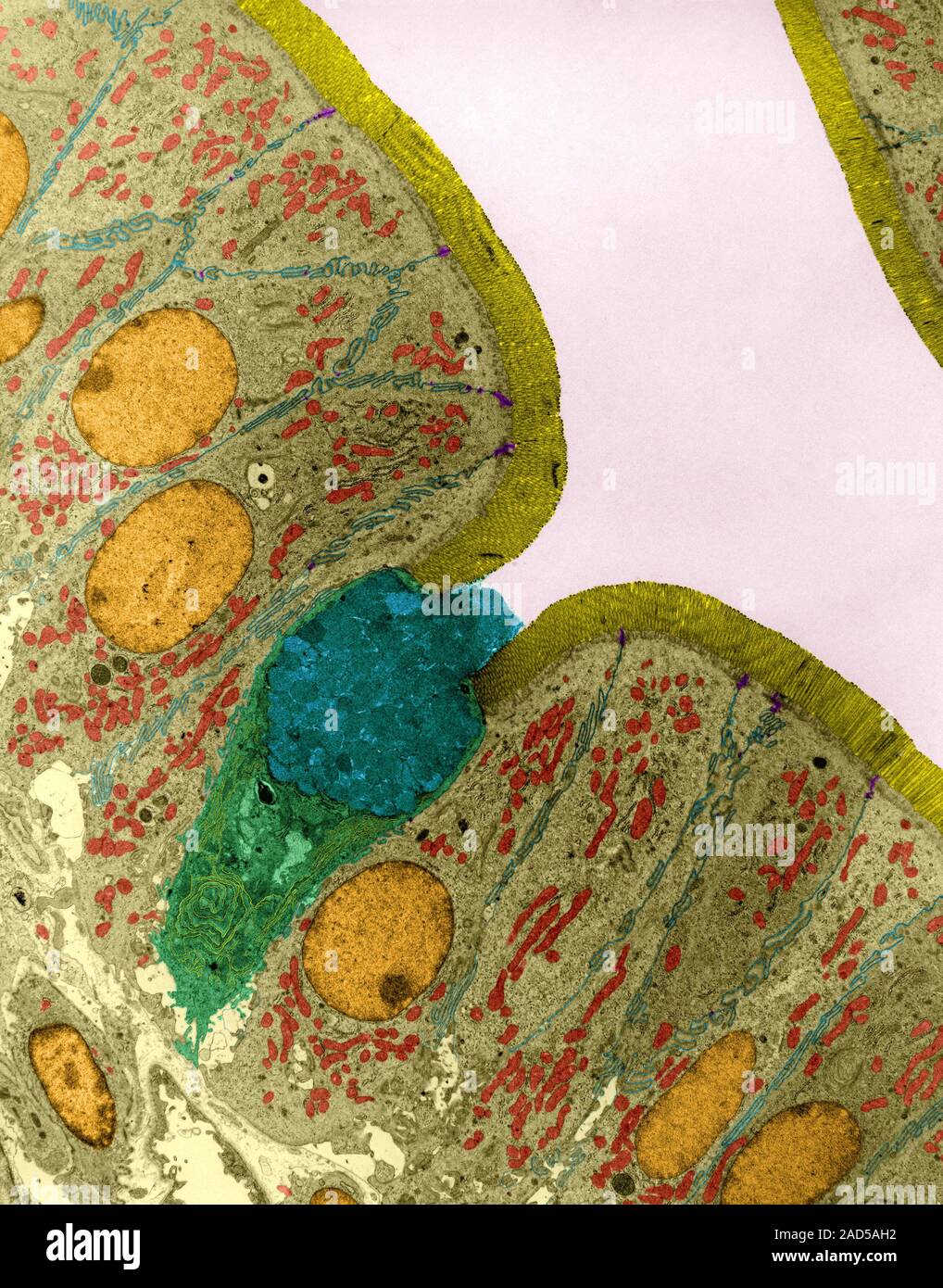 Goblet cell (blue-green) in the mucosal lining of the small intestine ...