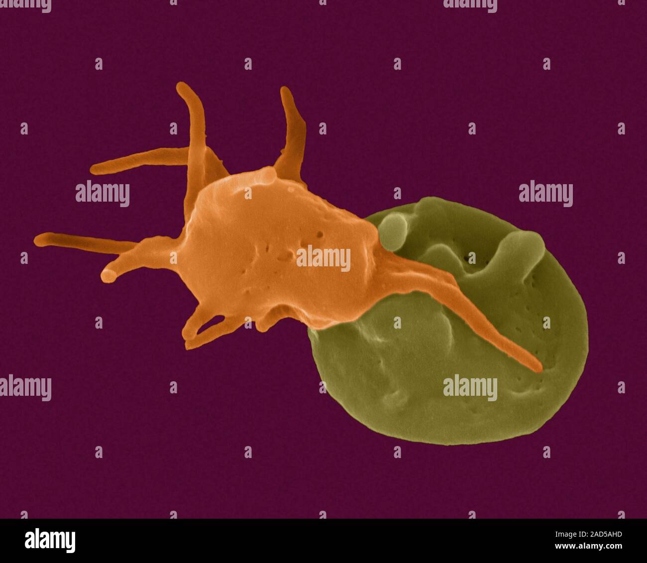 Activated and partially activated platelets with channels of the open ...