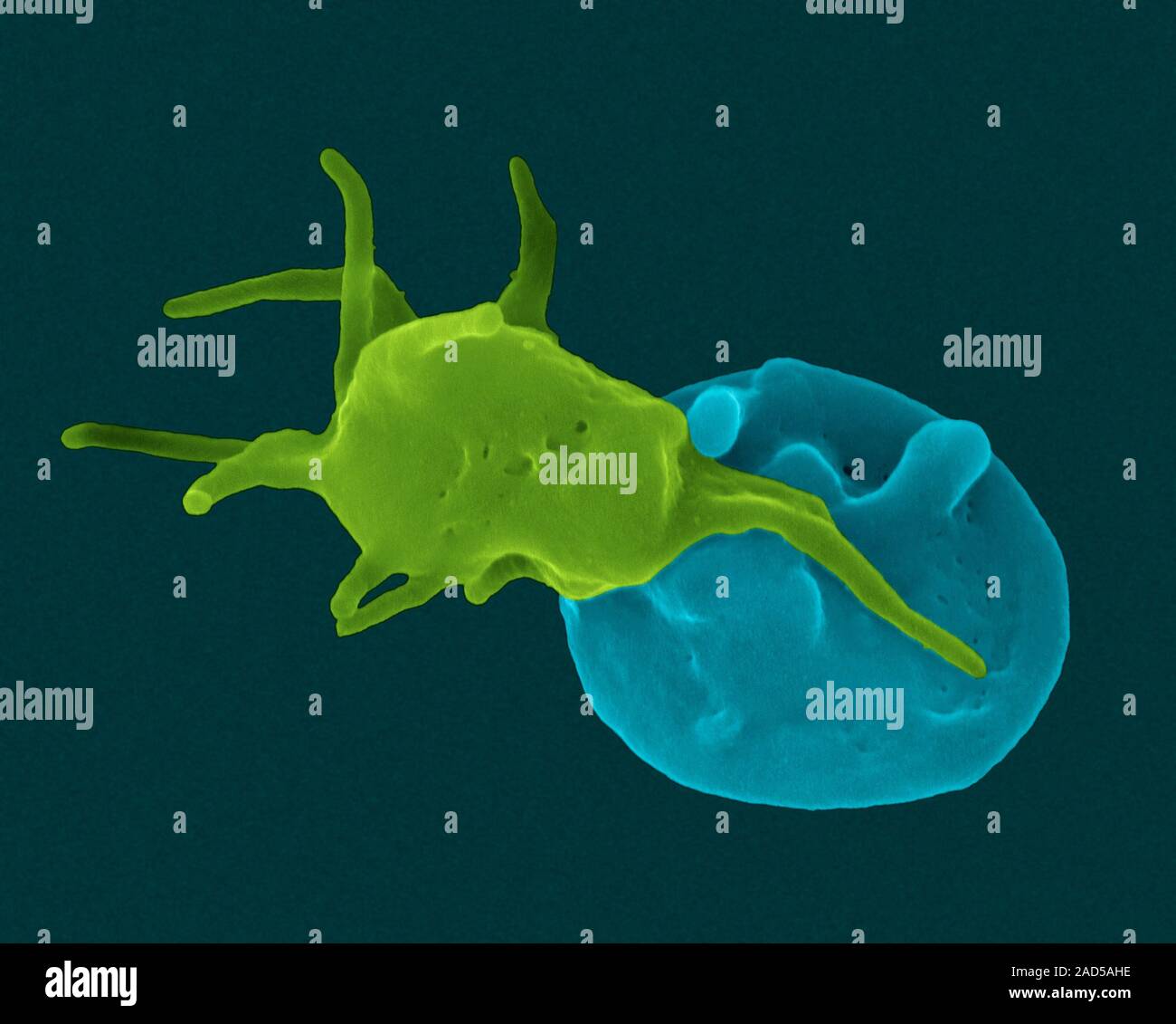 Activated and partially activated platelets with channels of the open ...