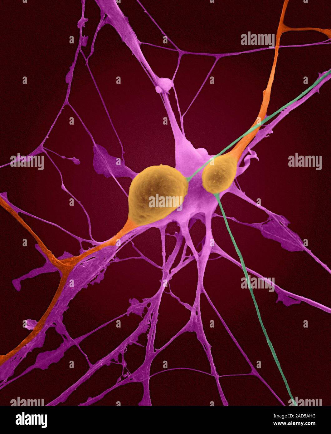 Pyramidal neurons from the central nervous system growing on a ...