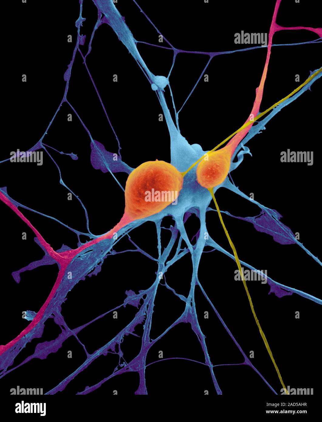 Pyramidal neurons from the central nervous system growing on a ...