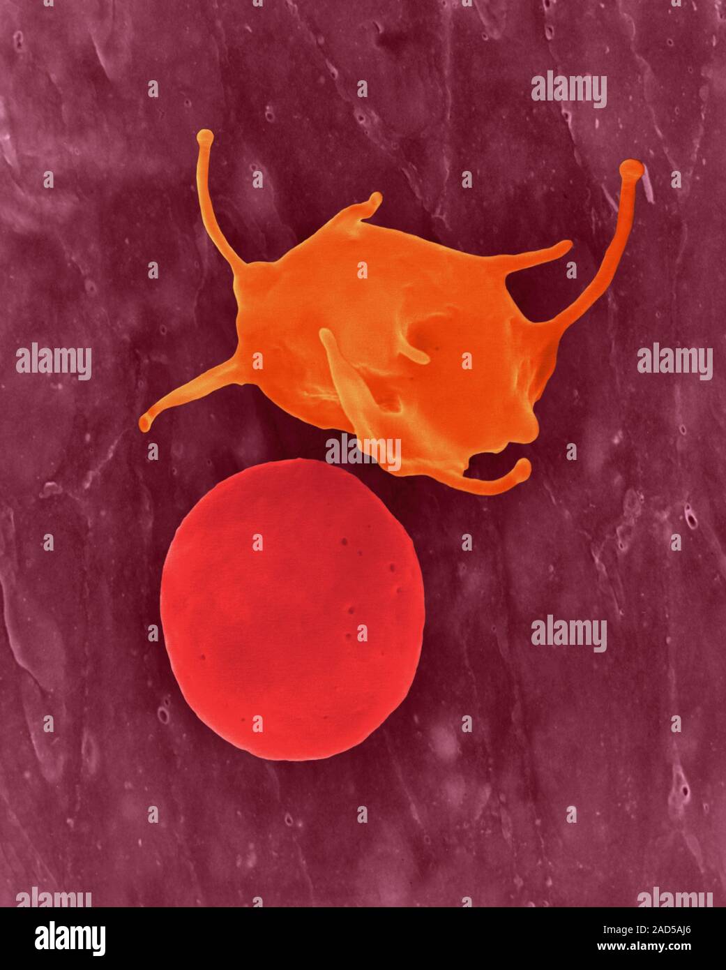 Activated and non-activated platelets on a blood vessel endothelia cell ... Activated and non-activated platelets on a blood vessel endothelia cell ...