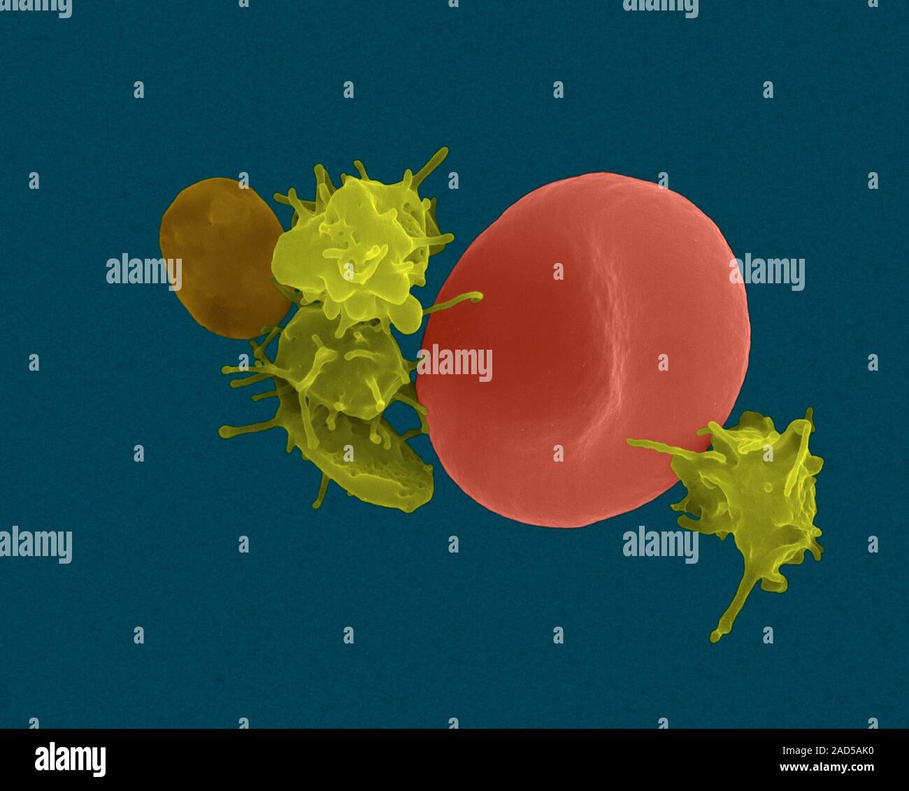 Activated (yellow, filopodial extensions) and non-activated (brown ...