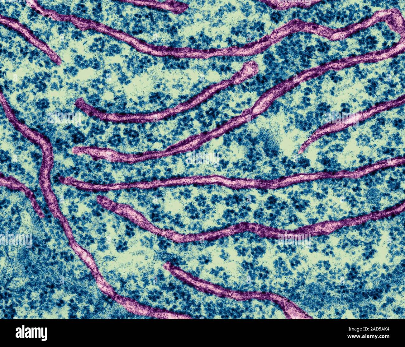 Smooth Endoplasmic Reticulum Electron Micrograph