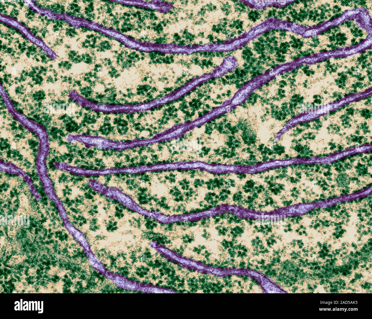 Rough endoplasmic reticulum with ribosomes on the surface (mammal ...
