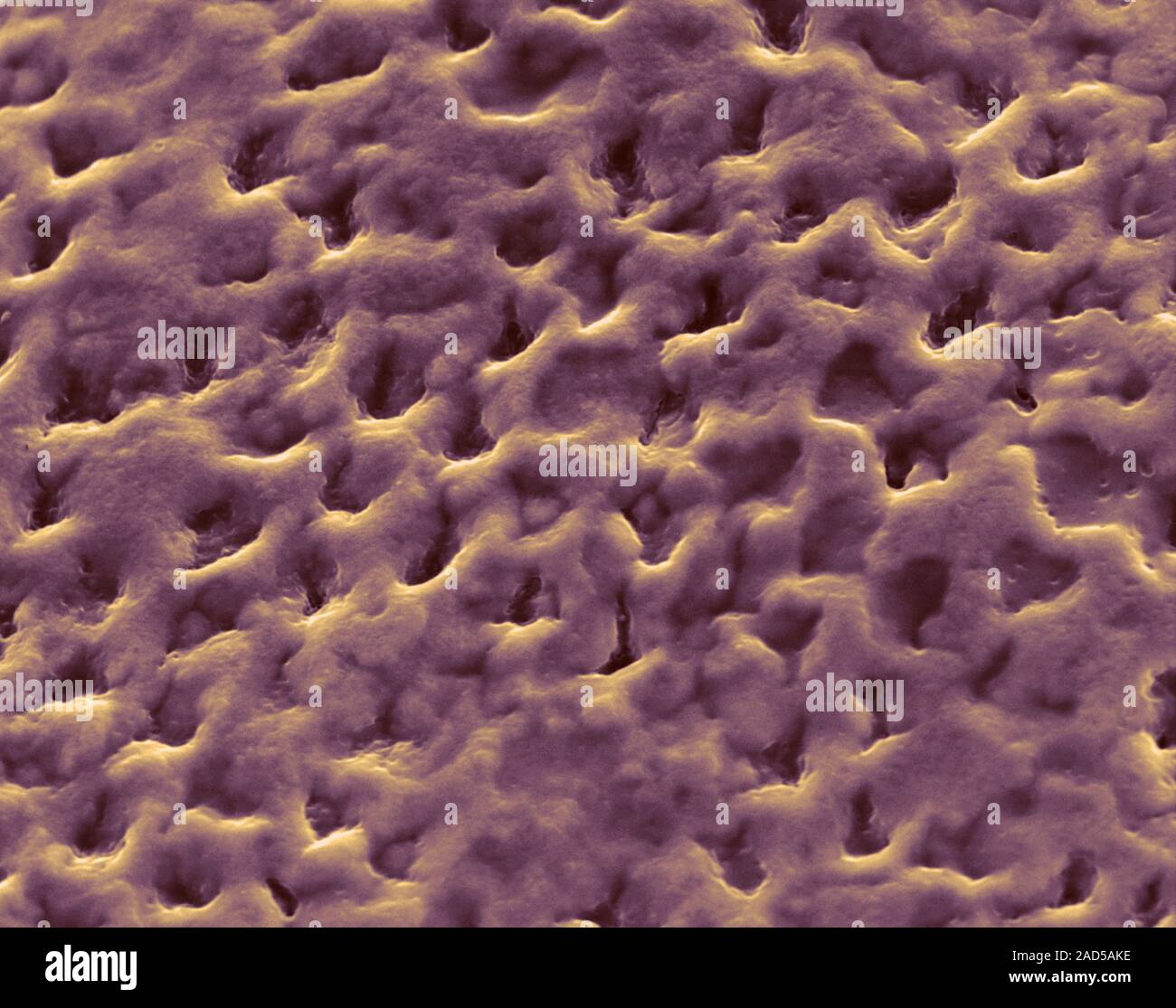 Human tooth enamel surface, coloured scanning electron micrograph (SEM ...