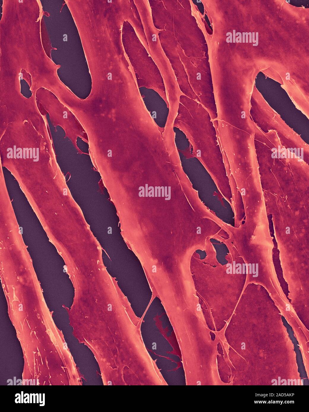 Human fibroblasts in culture, coloured scanning electron micrograph ...