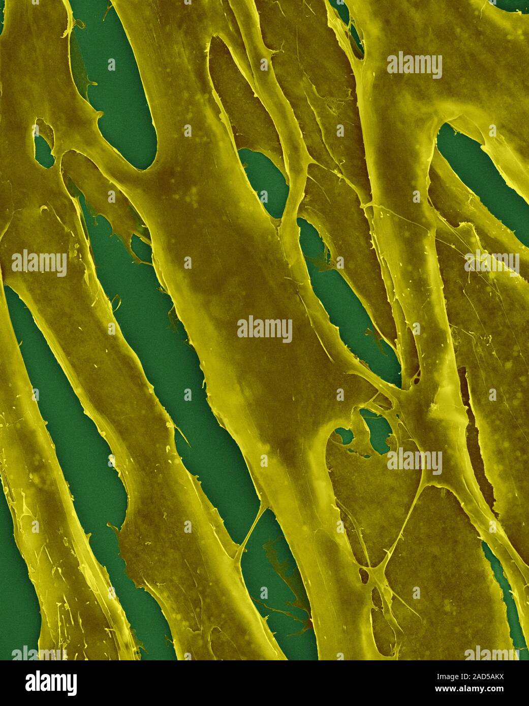 Human fibroblasts in culture, coloured scanning electron micrograph ...