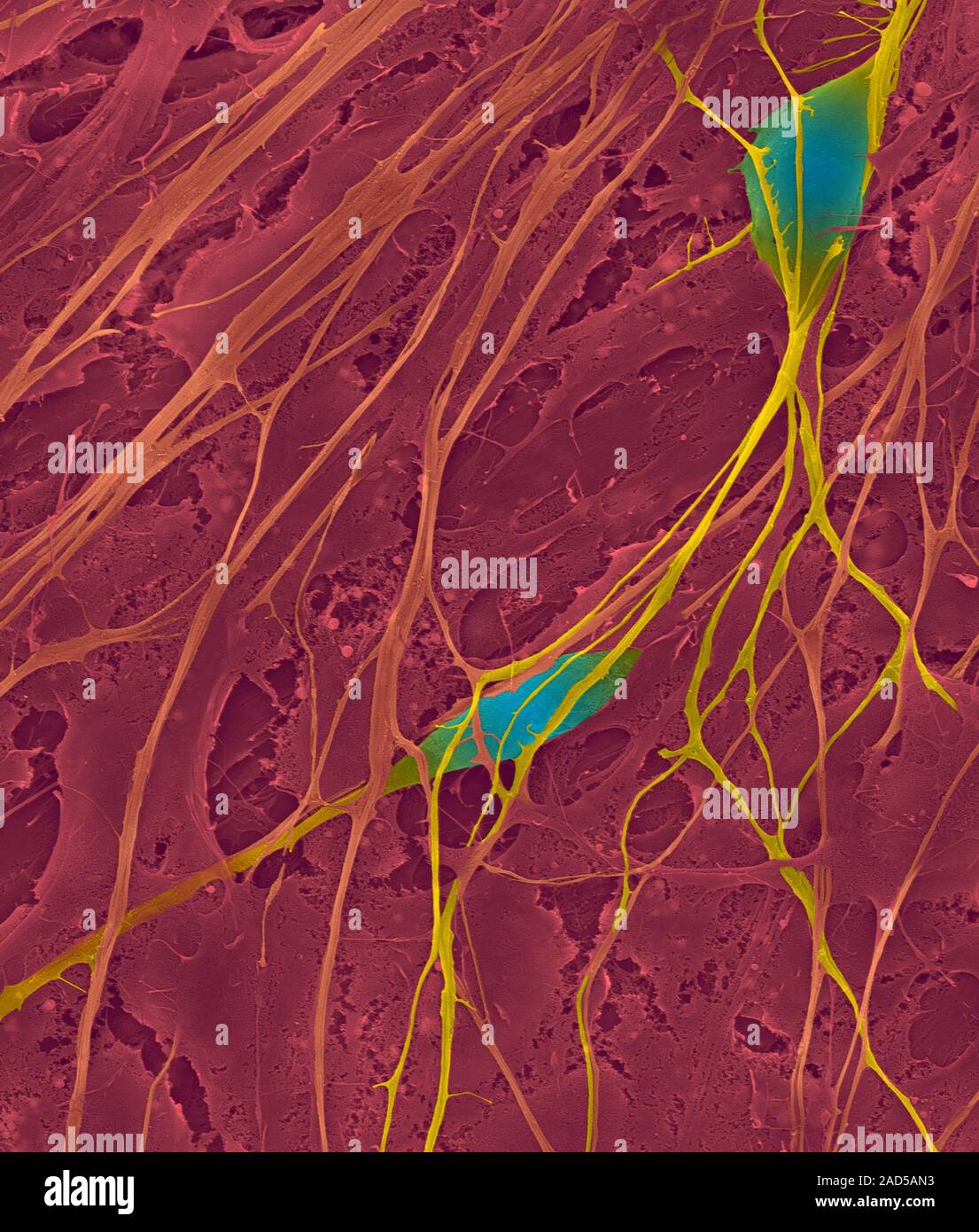 Human embryonic stem cells (HESCs) differentiating on a fibroblast ...