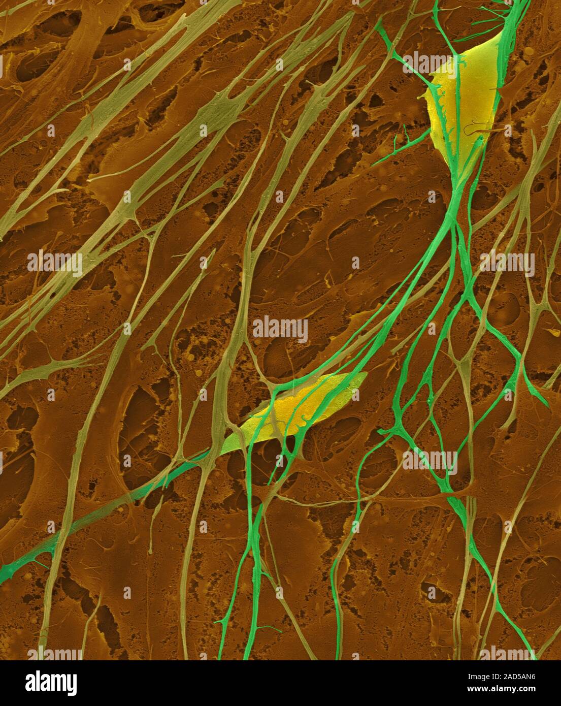 Human embryonic stem cells (HESCs) differentiating on a fibroblast ...