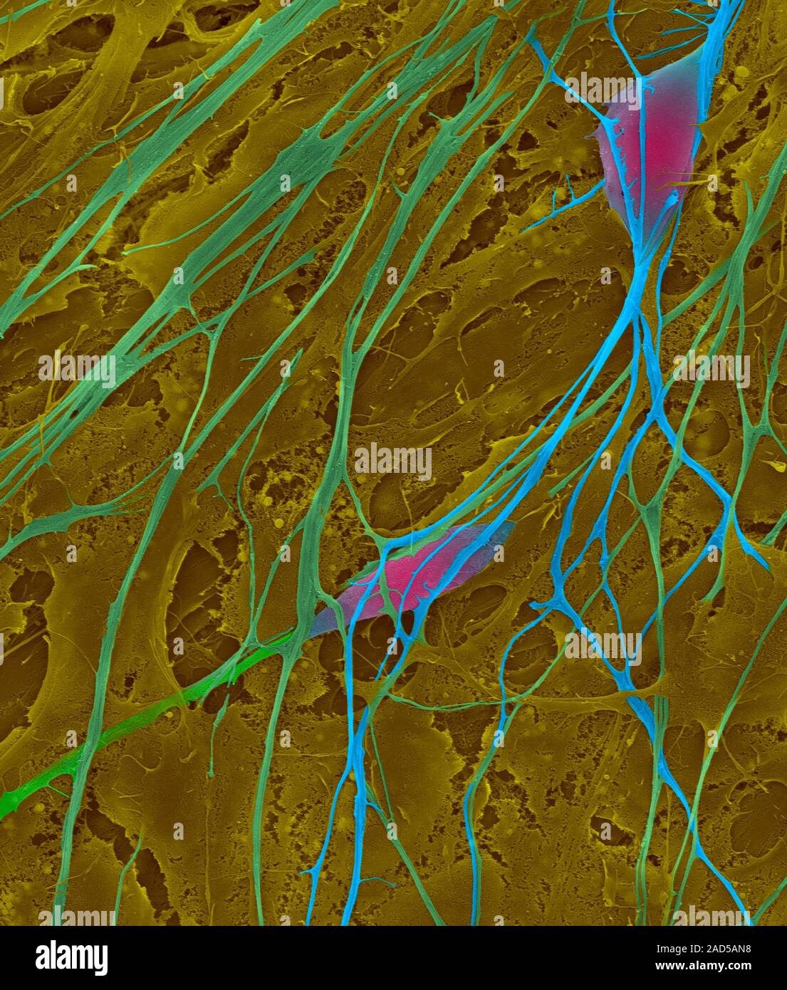 Human embryonic stem cells (HESCs) differentiating on a fibroblast ...