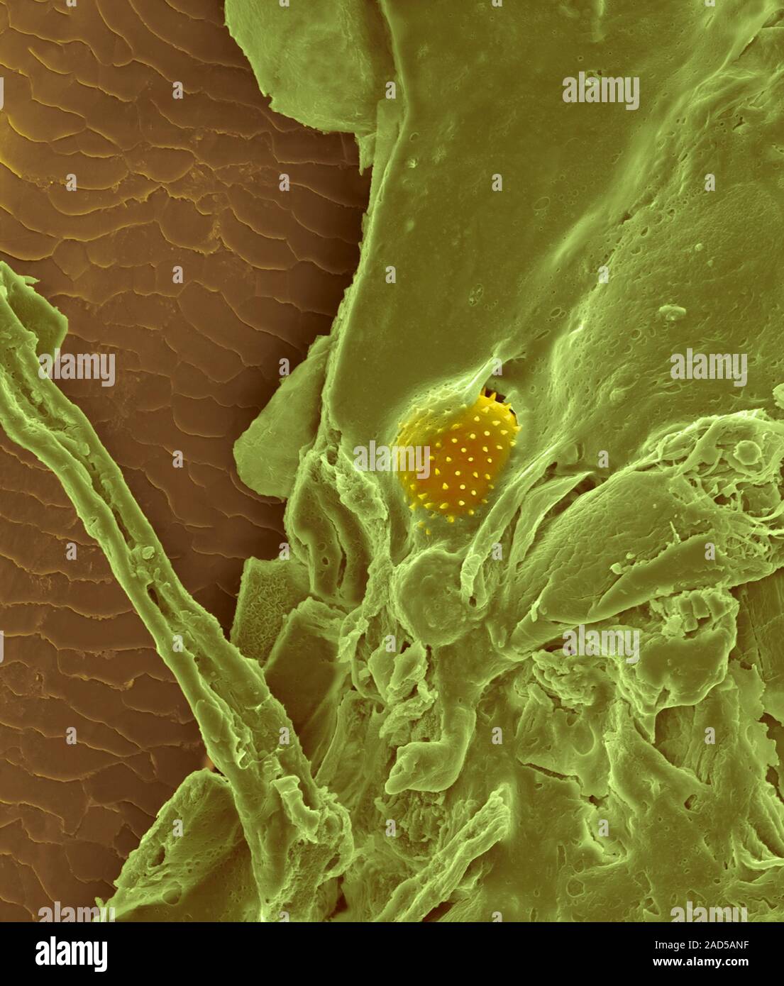 Nose hair with mucus and trapped pollen grain, coloured scanning ...