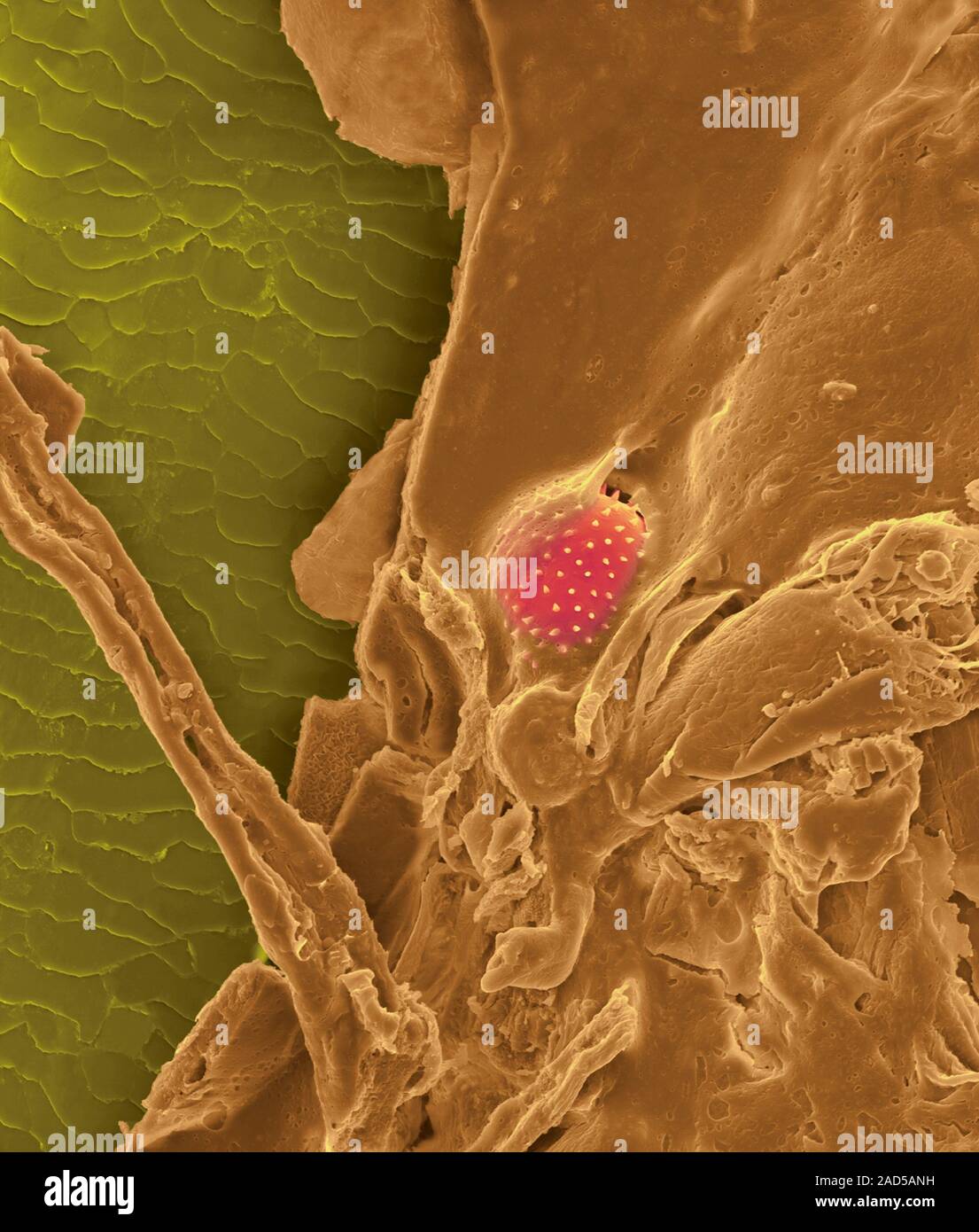 Nose hair with mucus and trapped pollen grain, coloured scanning ...