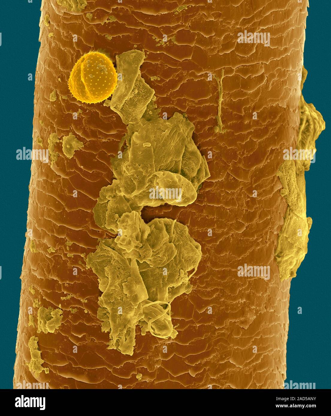 Nose hair with pollen grain, mucus and dead skin cells, coloured ...