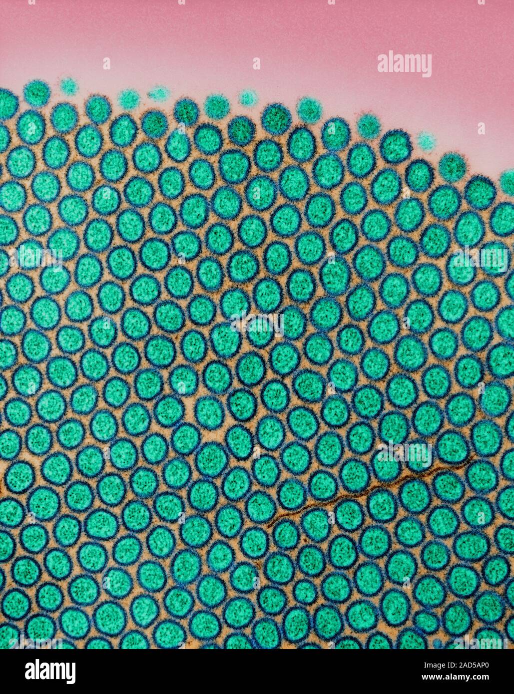 Villus of the small intestine (human), coloured transmission electron ...