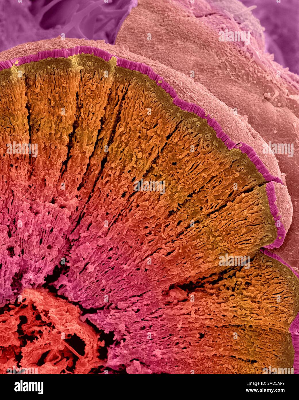 Small intestine villus, coloured scanning electron micrograph (SEM ...