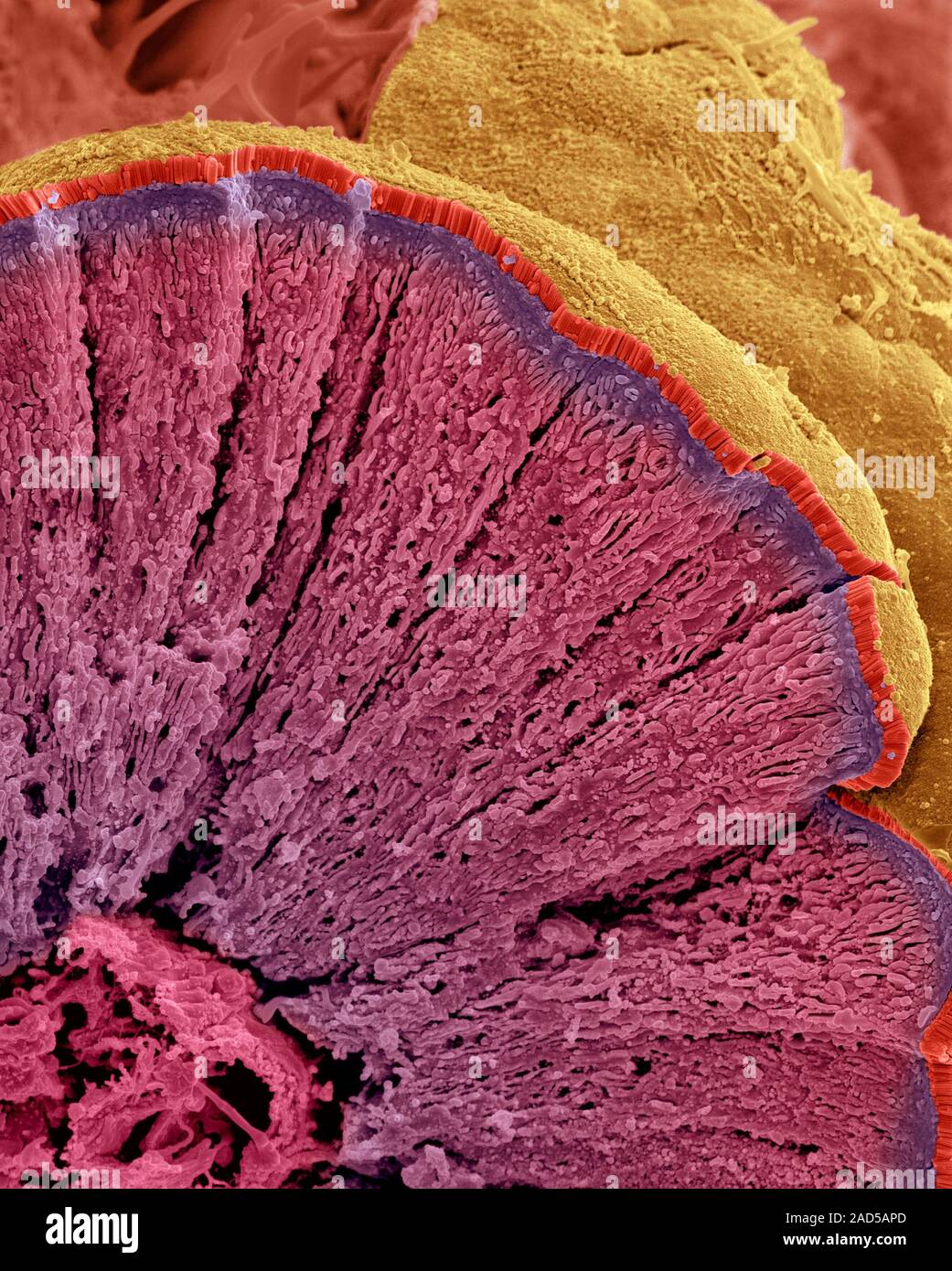 Small Intestine Villus Coloured Scanning Electron Micrograph Sem Columnar Epithelial Cells