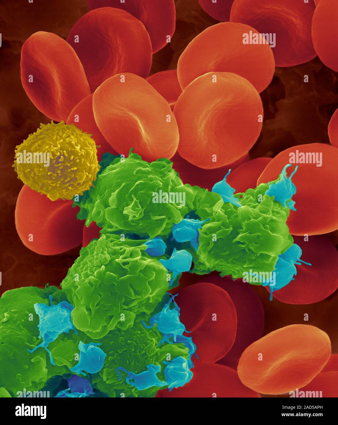 Human red blood cells, activated platelets, T lymphocyte (yellow) and ...