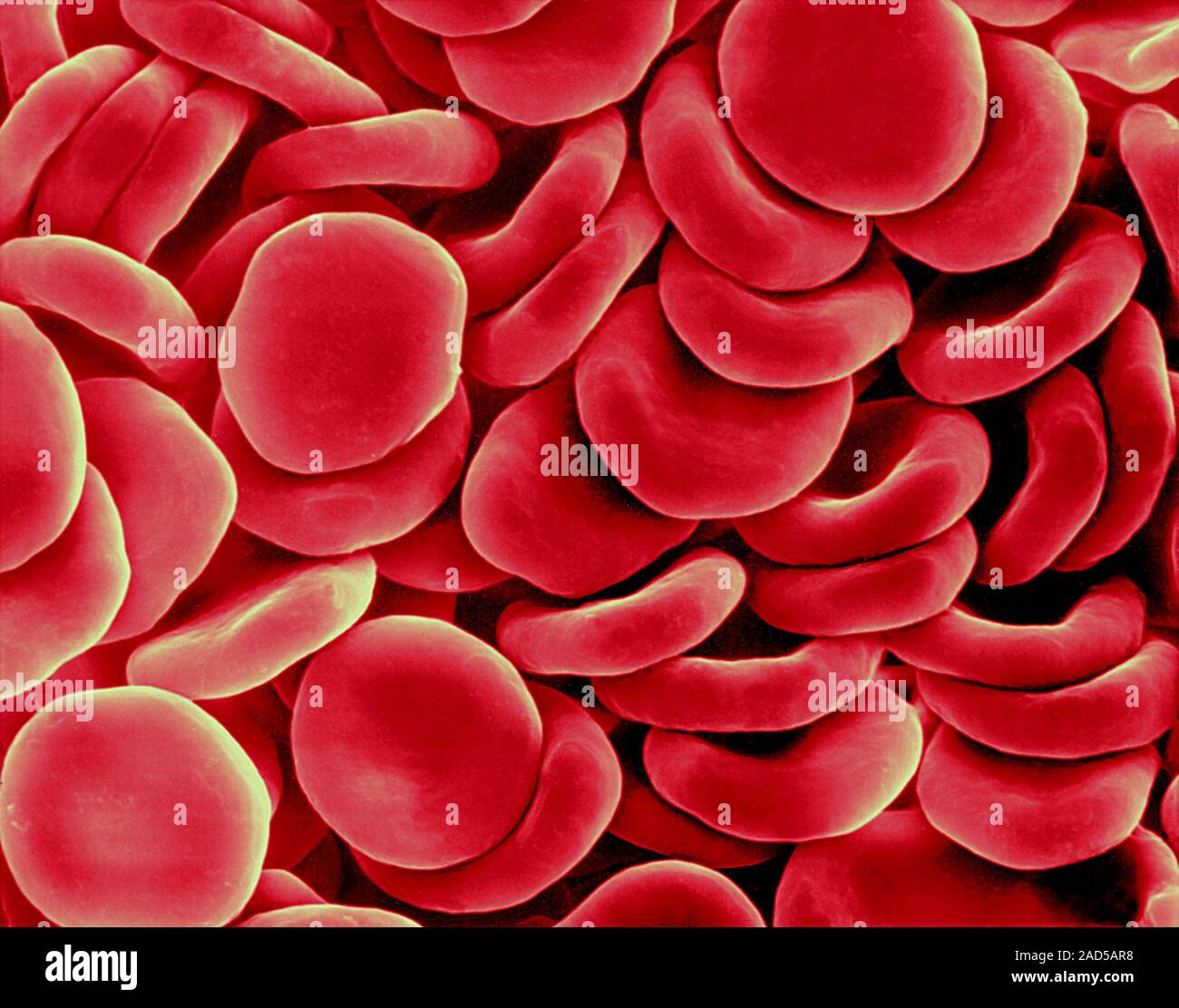 Human red blood cells (RBCs, isotonic), coloured scanning electron ...