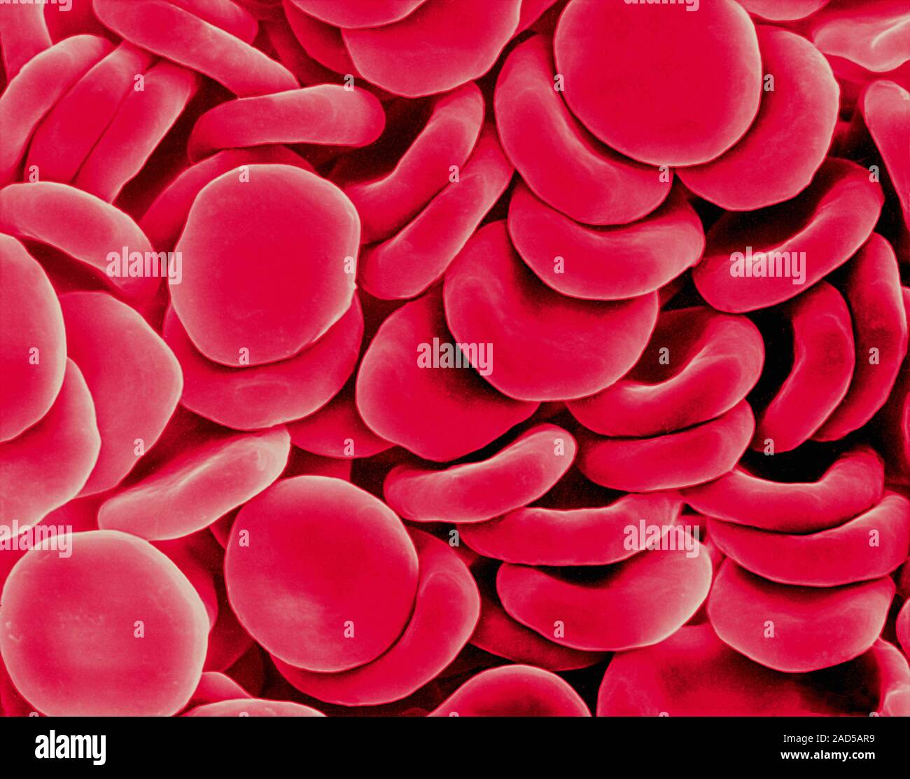 Human red blood cells (RBCs, isotonic), coloured scanning electron ...